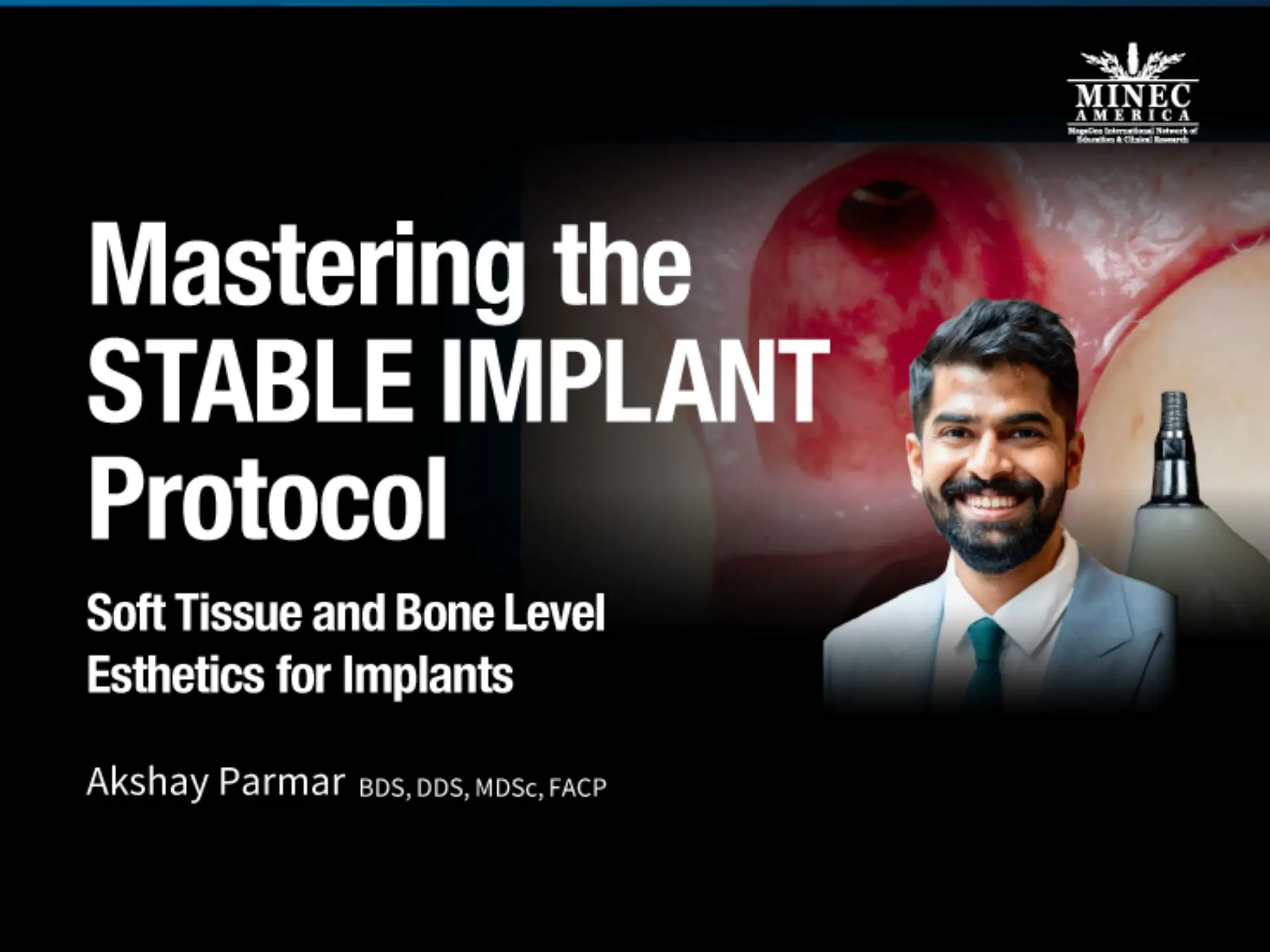 Mastering the STABLE IMPLANT Protocol - MINEC America